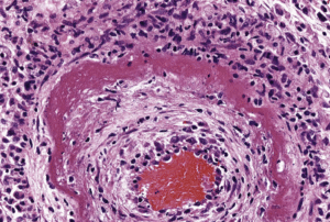 The Morphology of Necrosis: Understanding the Patterns of Cell Death