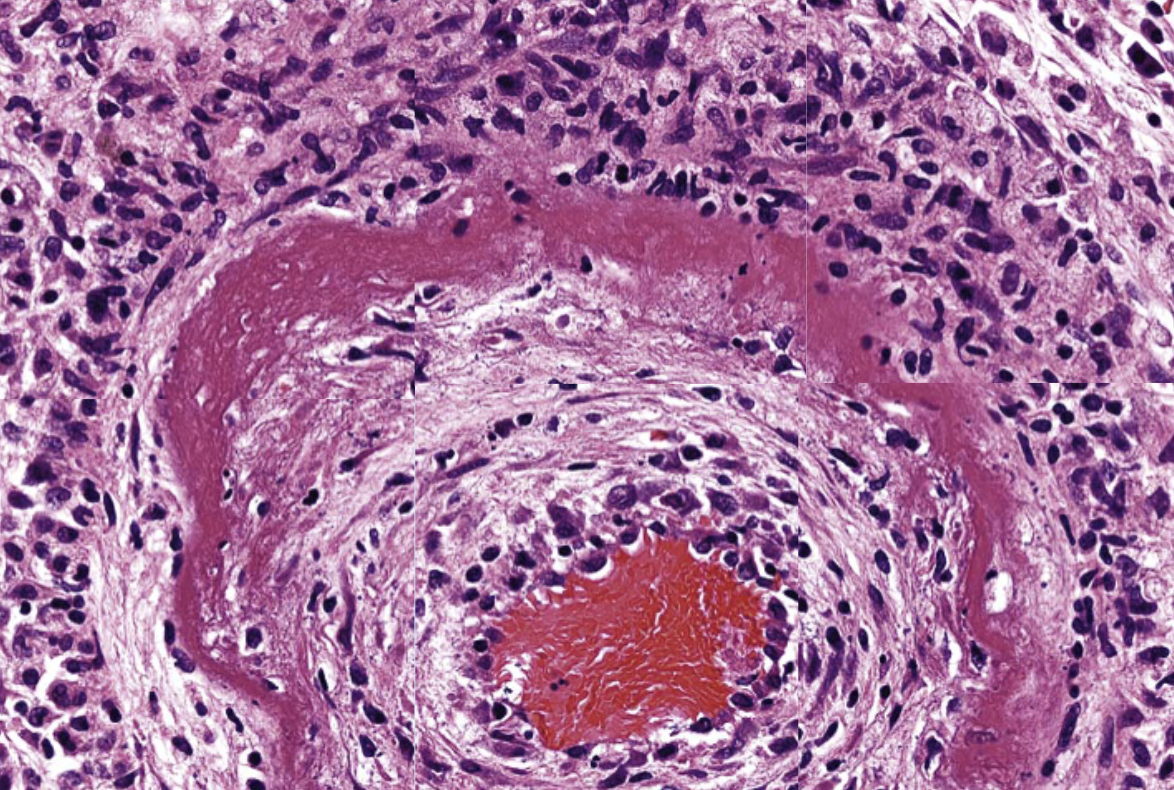 The Morphology of Necrosis: Understanding the Patterns of Cell Death