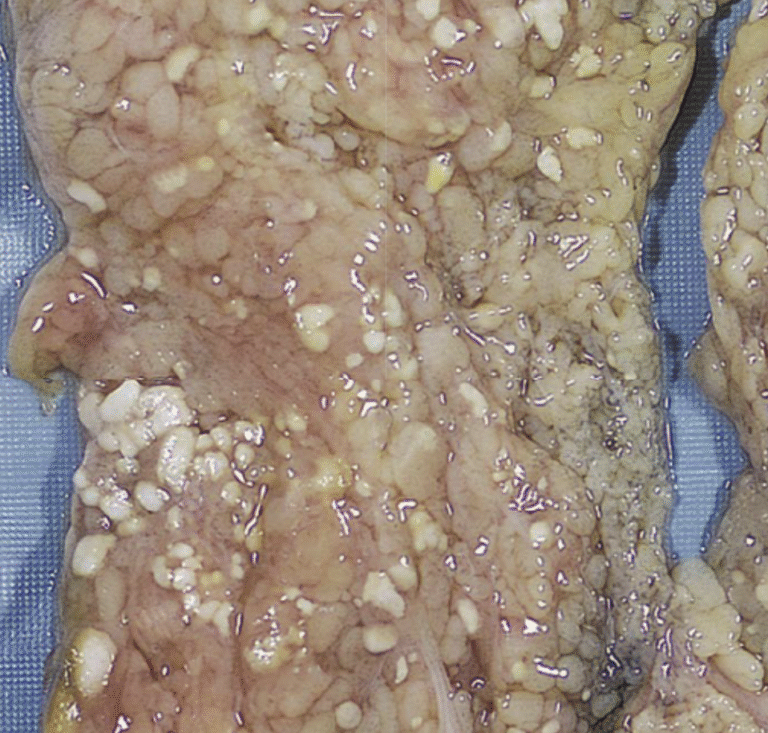 The Morphology of Necrosis: Understanding the Patterns of Cell Death