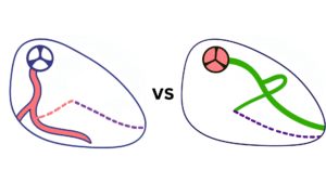 Right vs Left Coronary Dominance Explained