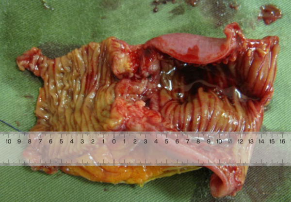 How to Describe Gross Pathology Specimens