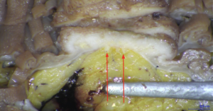 How to Describe Gross Pathology Specimens